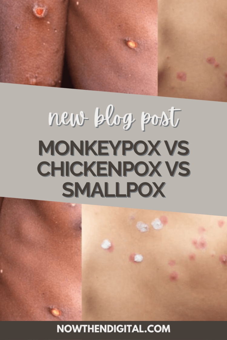 The Difference Between Monkeypox, Chickenpox, and Smallpox - Now Then ...