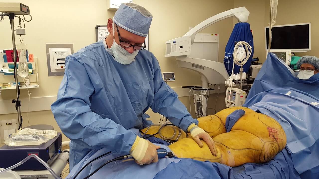 A Comparison of the Different Types of Liposuction - Now Then Digital