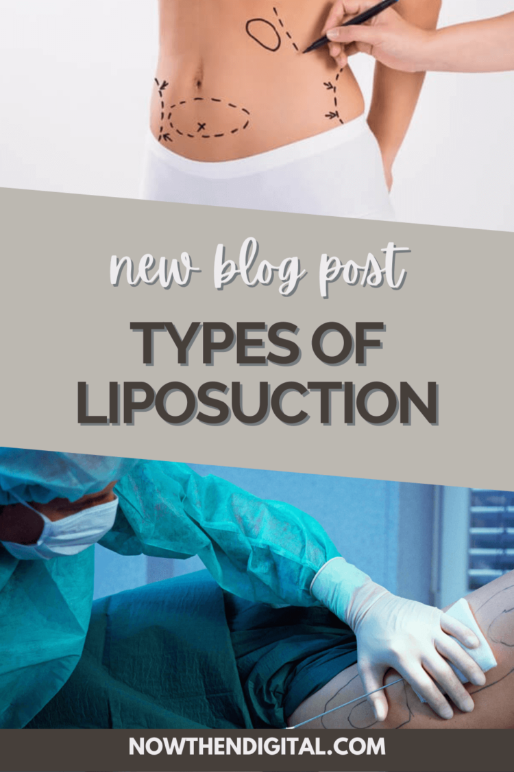 A Comparison of the Different Types of Liposuction - Now Then Digital