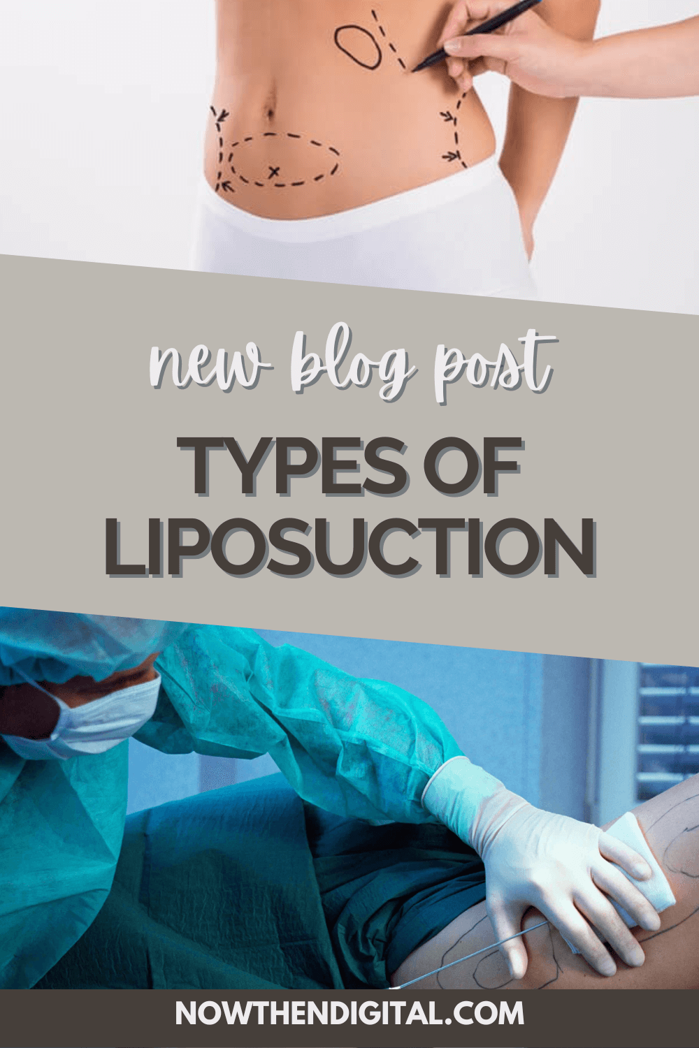 A Comparison of the Different Types of Liposuction - Now Then Digital