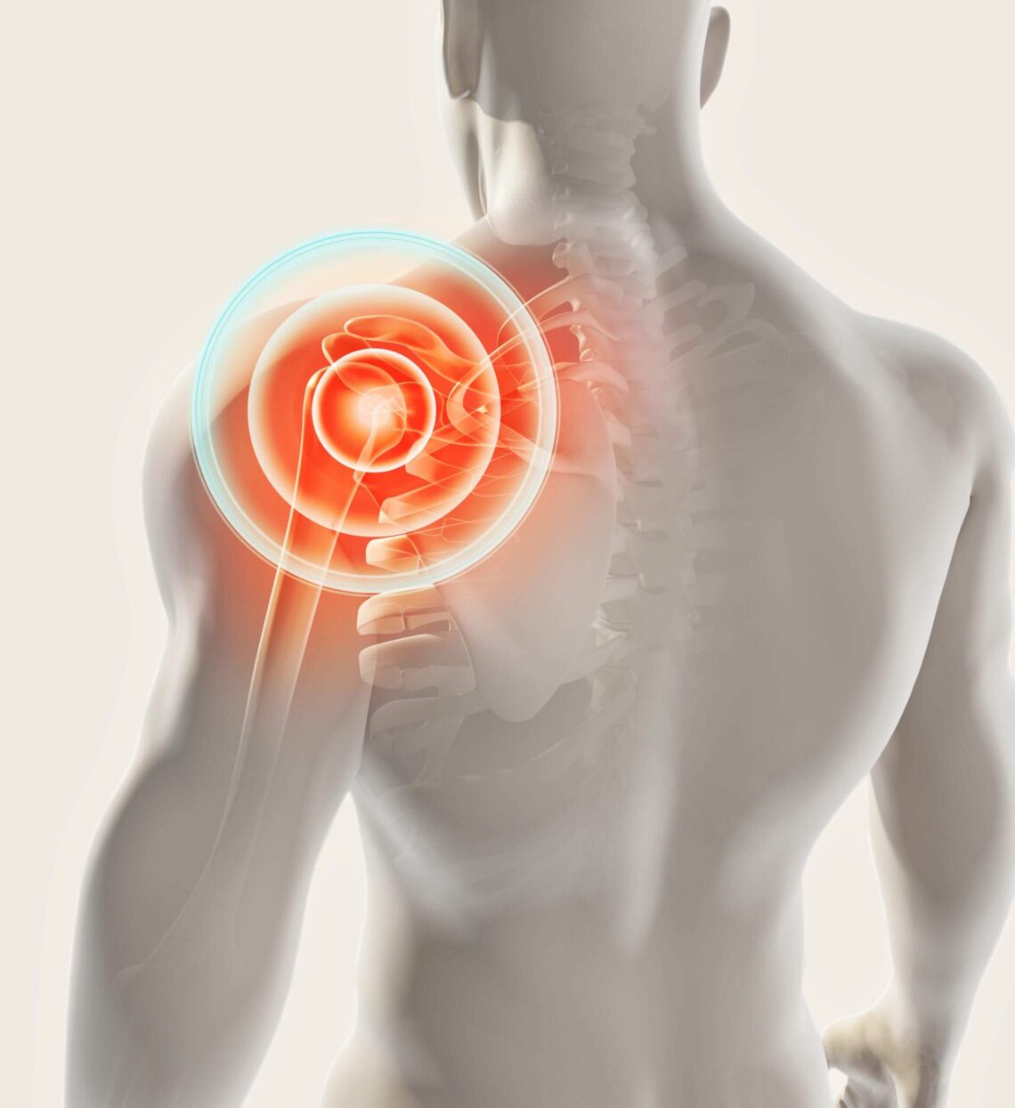 Shoulder Labrum Tear Test: How to Diagnose and Treat this Common Injury ...