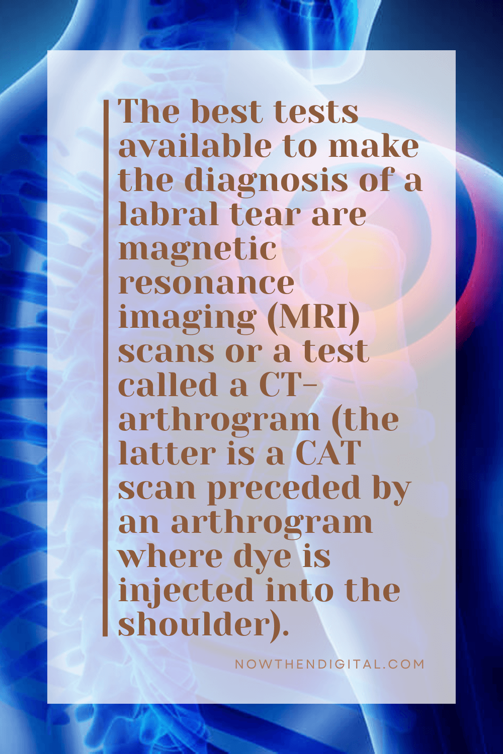 Shoulder Labrum Tear Test: How to Diagnose and Treat this Common Injury ...
