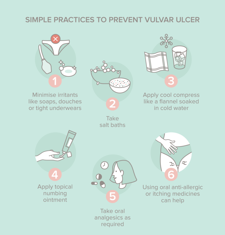 Understanding Vulvar Ulcers: Causes, Symptoms, and Treatment Options ...